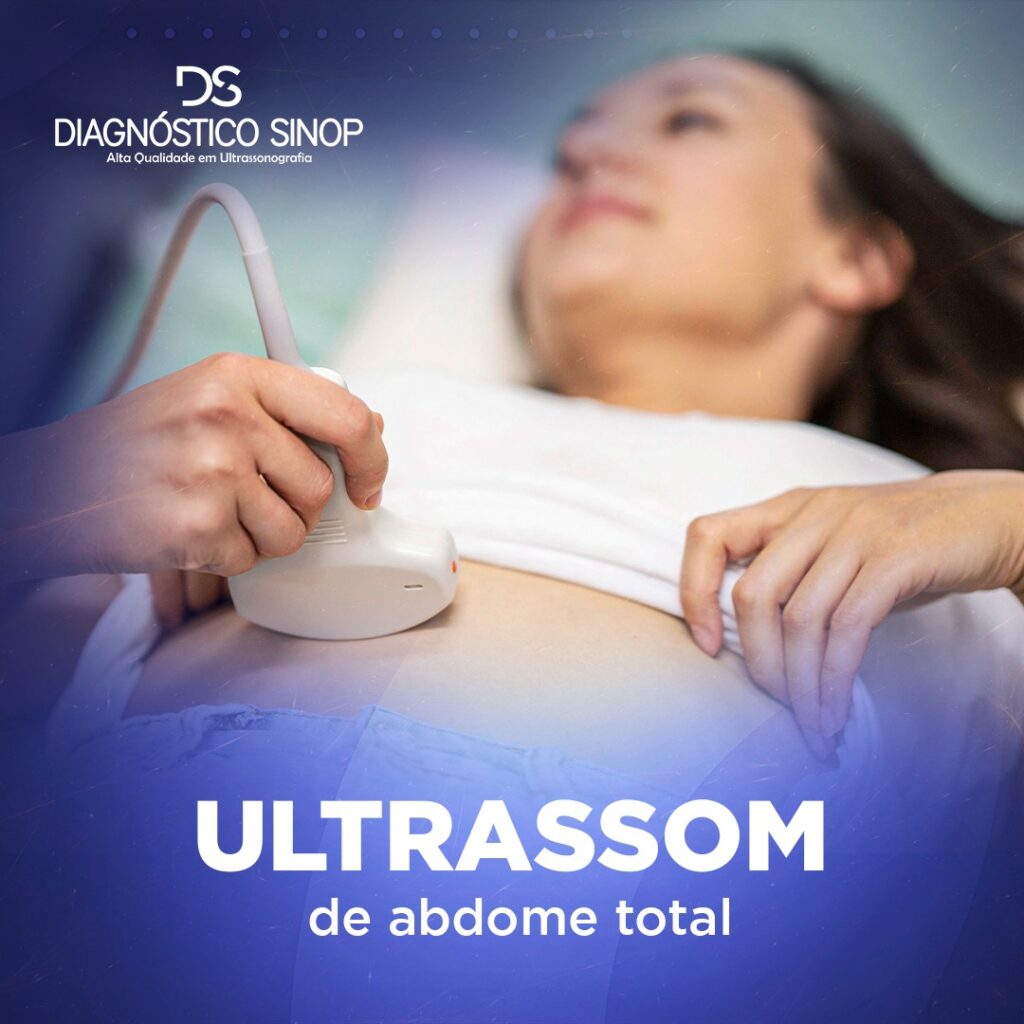 Ultrassom de abdome total – Diagnóstico Sinop
